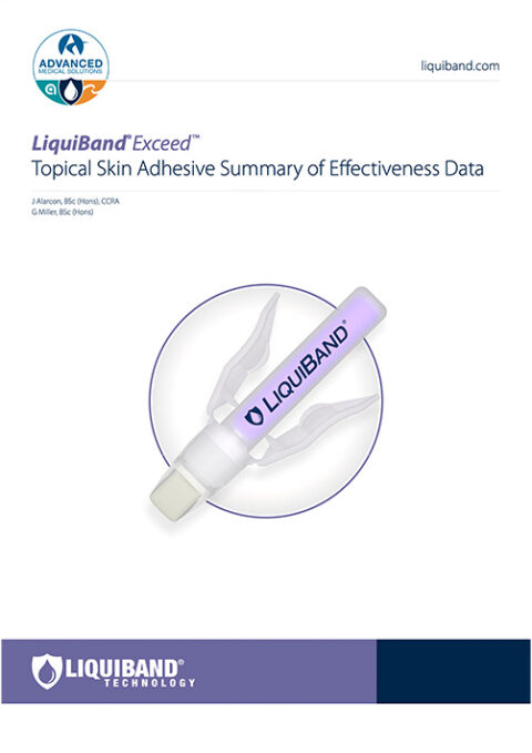 LiquiBand® Exceed™ - Controlled Wound Closure